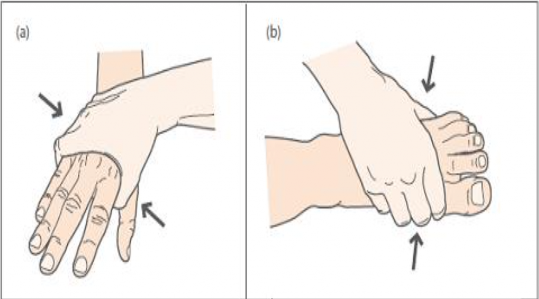 Rheumatology – Early Arthritis Clinic – GP Gateway