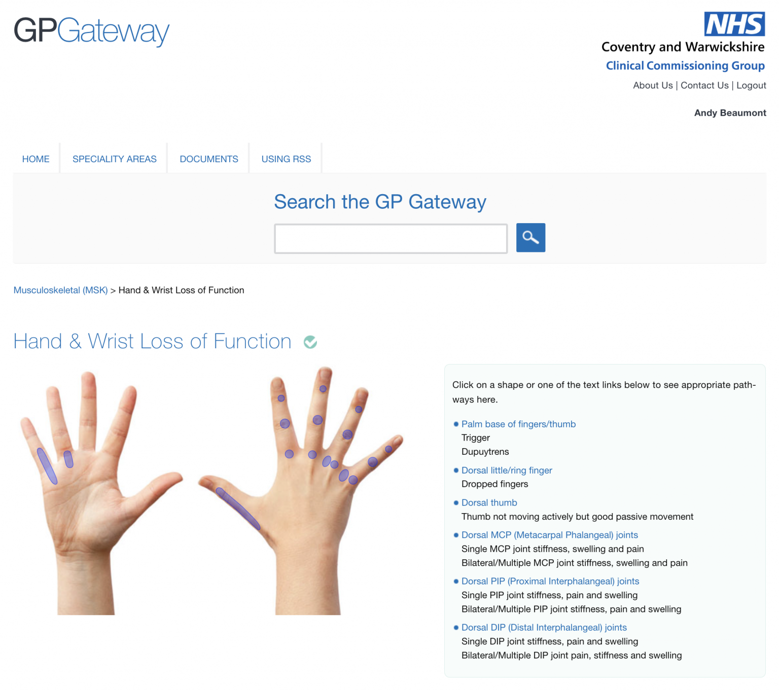 Carpal Tunnel Syndrome (CTS) – GP Gateway