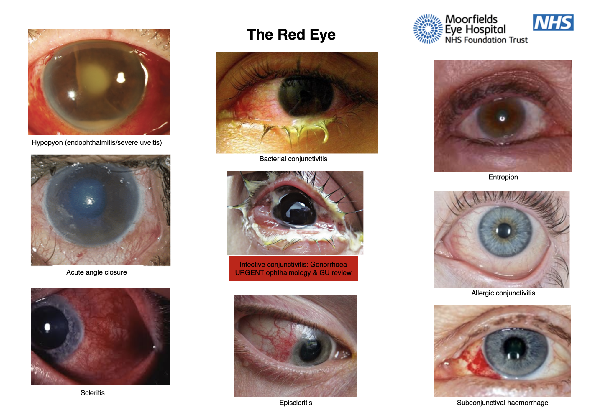 Management of Common Eye Conditions – GP Gateway